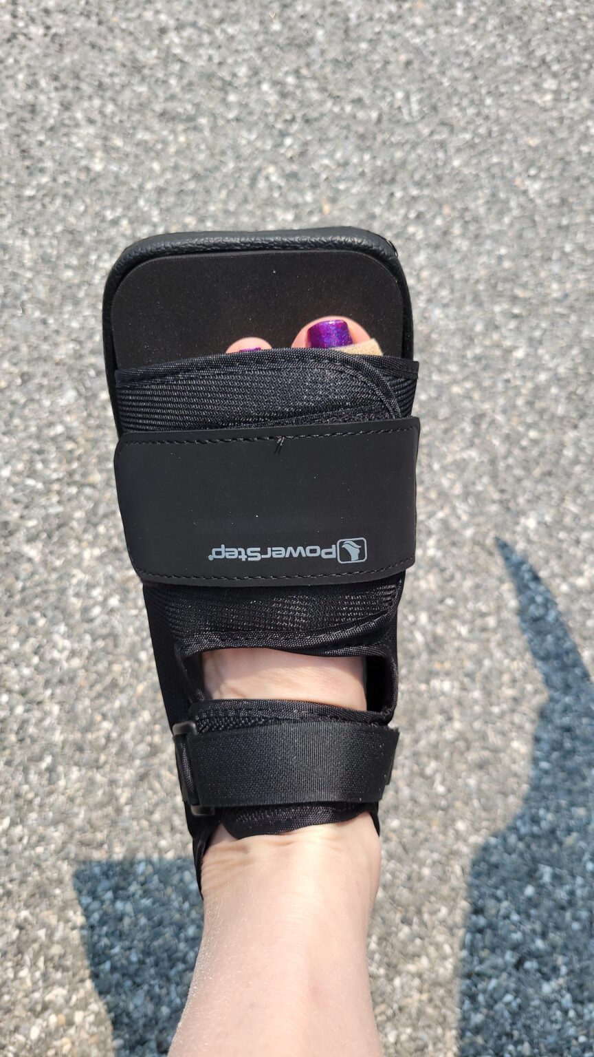 A Fence for the Dog and How I Broke my Toe – B4 and Afters